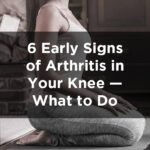 6 Early Signs Of Arthritis In Your Knee—What To Do – Kneele